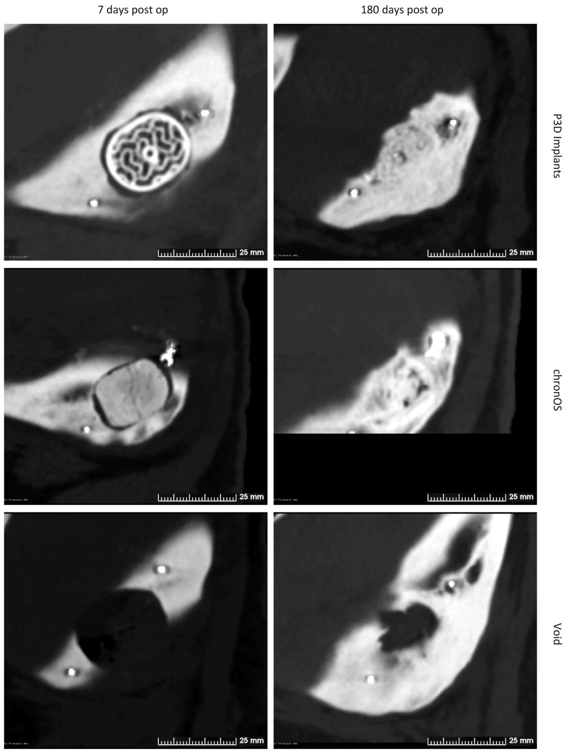 3D printed resorbable implants in the mandible of pigs - Ossiform - W E ...