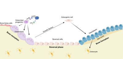 How do bones function and what are they made of? - Ossiform - W E PRINT ...