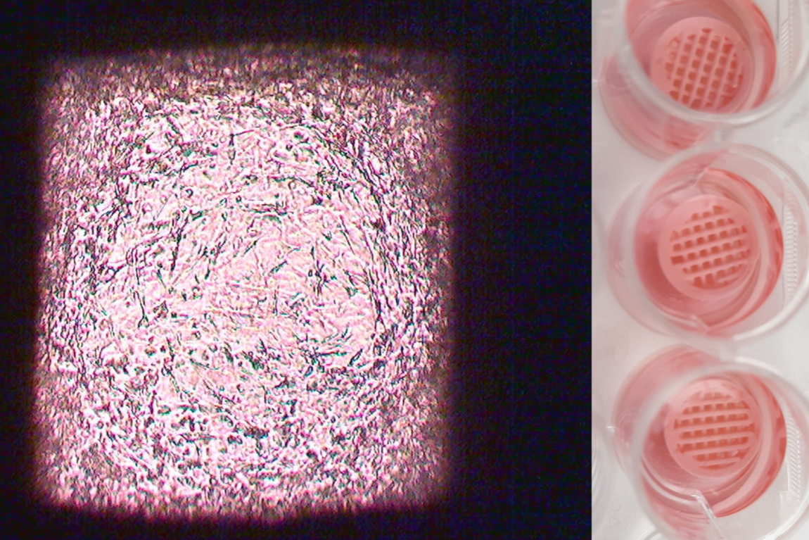 Osteoblasts living in culture on P3D Scaffolds for 20 weeks - Ossiform ...
