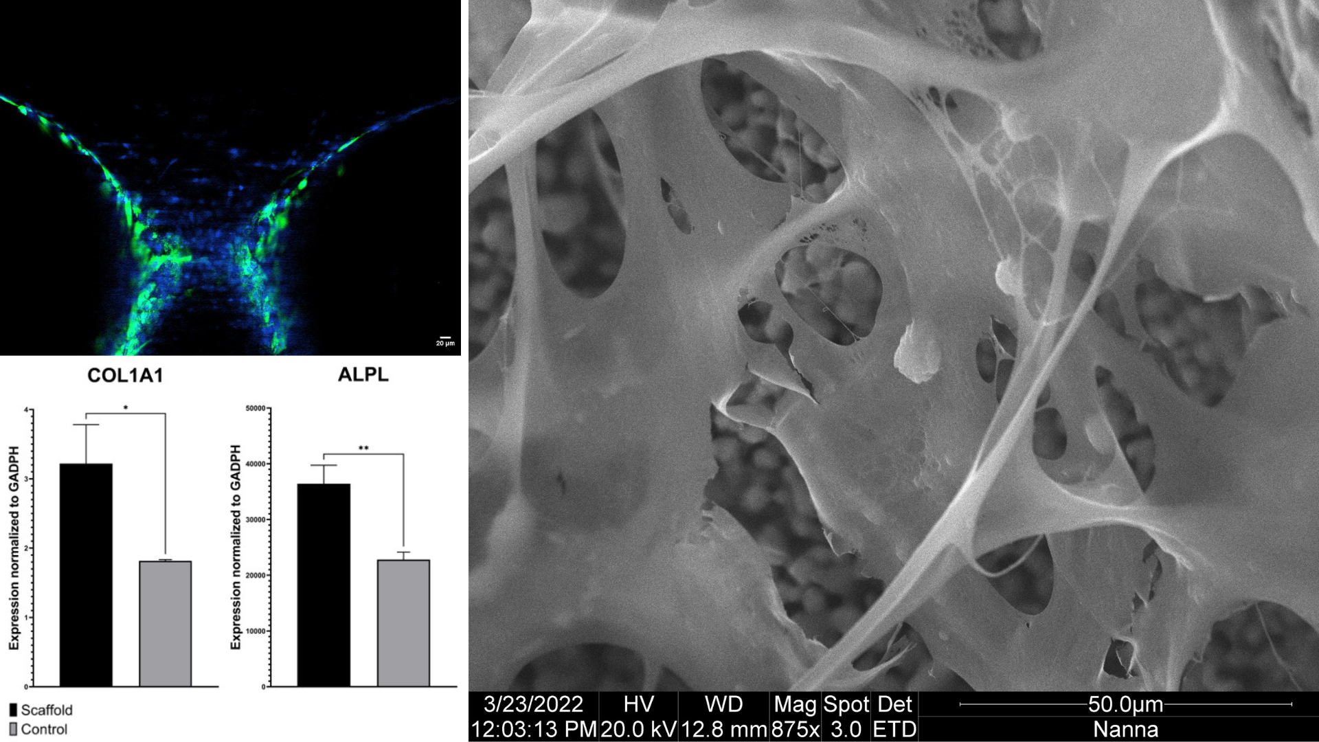 P3D Scaffolds support normal morphology of osteoblasts - Ossiform - W E ...