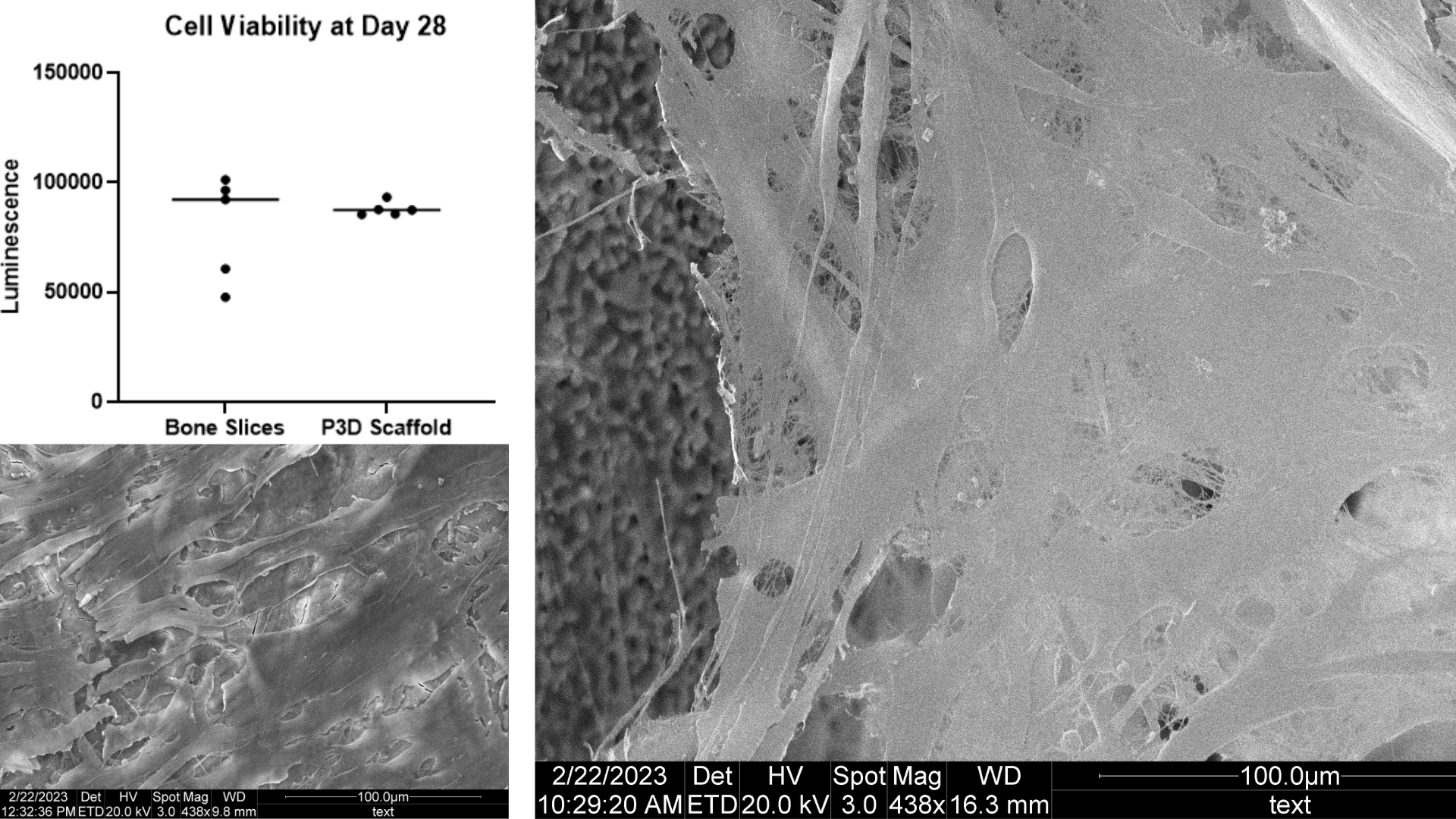 Comparing P3D Scaffolds to slices of real bone - Ossiform - W E PRINT BONE