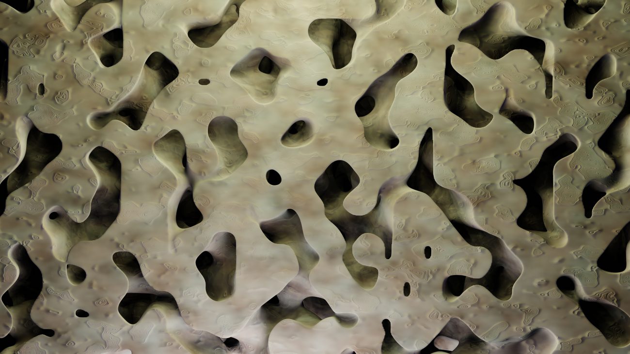 Hydrogels versus Scaffolds: When to Choose What? - Ossiform - W E PRINT ...