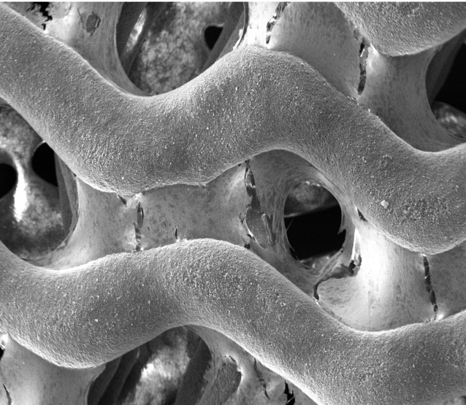 Hydrogels versus Scaffolds: When to Choose What? - Ossiform - W E PRINT ...