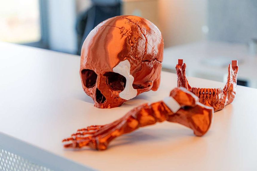 NEWS - Ossiform - W E PRINT BONE